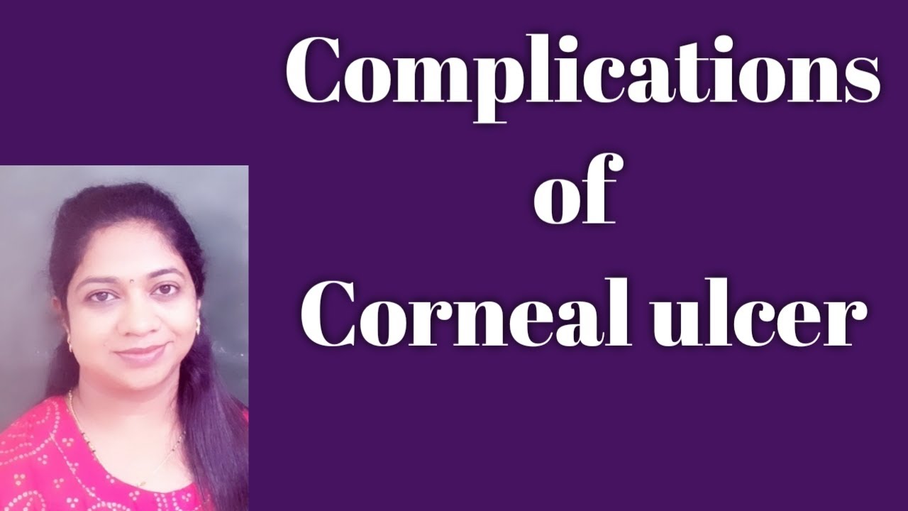 Complications of corneal ulcer || Perforation of corneal ulcer and its ...