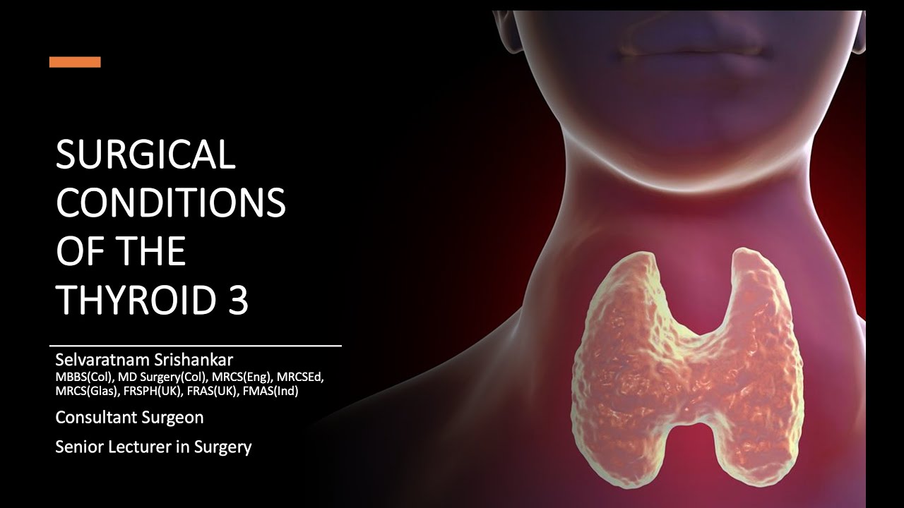 THYROID 3- Morphological abnormalities - YouTube