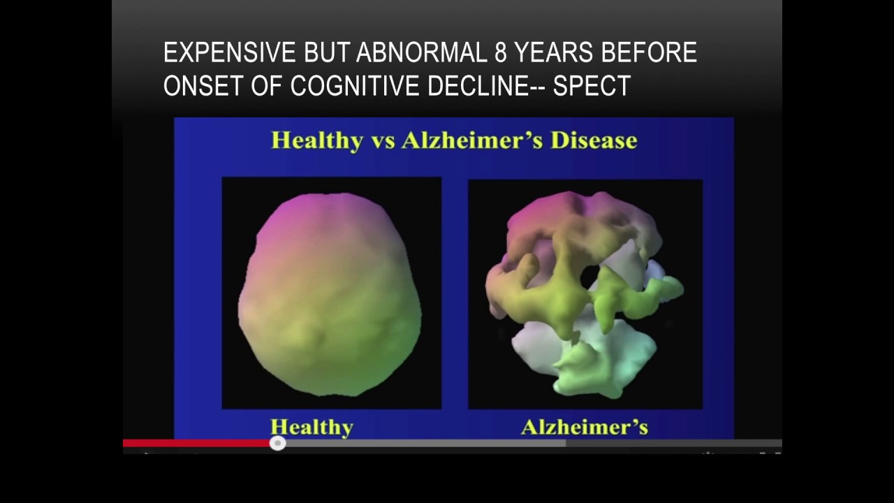 Protecting the Aging Brain | aging brain Detection and Prevention - YouTube