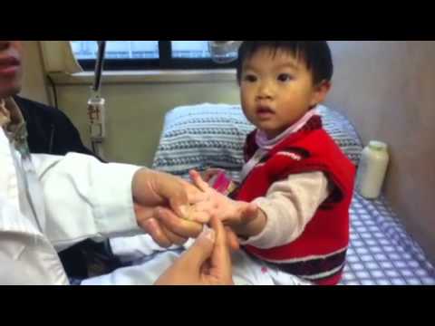 TCM Pediatrics Finger Diagnostics - YouTube