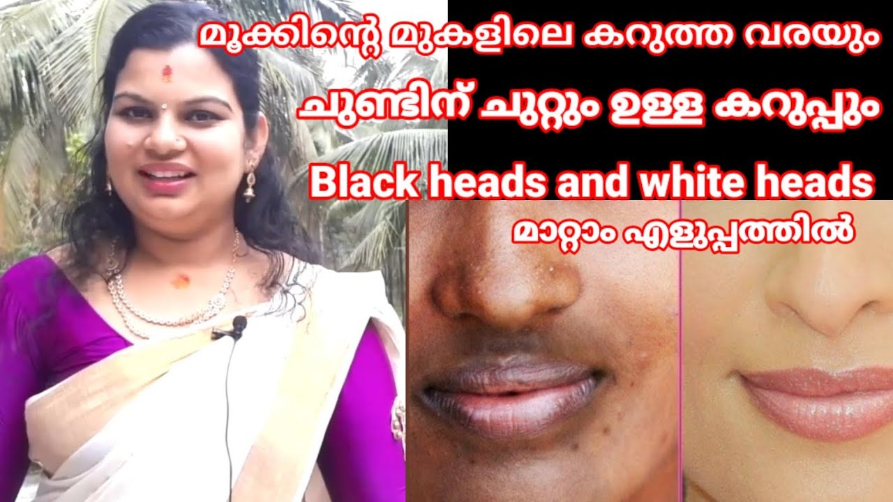 How To Remove Black Line Remove From Nose And Lips Black Head And how-to-remove-black-line-remove-from-nose-and-lips-black-head-and