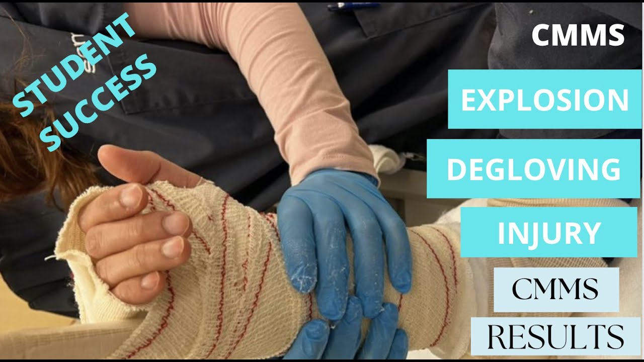 Explosion & devolving injury of the left hand & wrist and open fracture ...