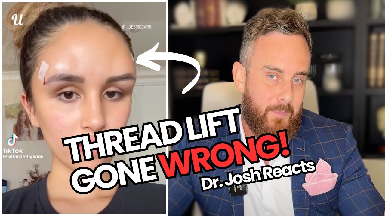 Cosmetic Doctor Reacts to Fox eye thread lift gone wrong !! - YouTube