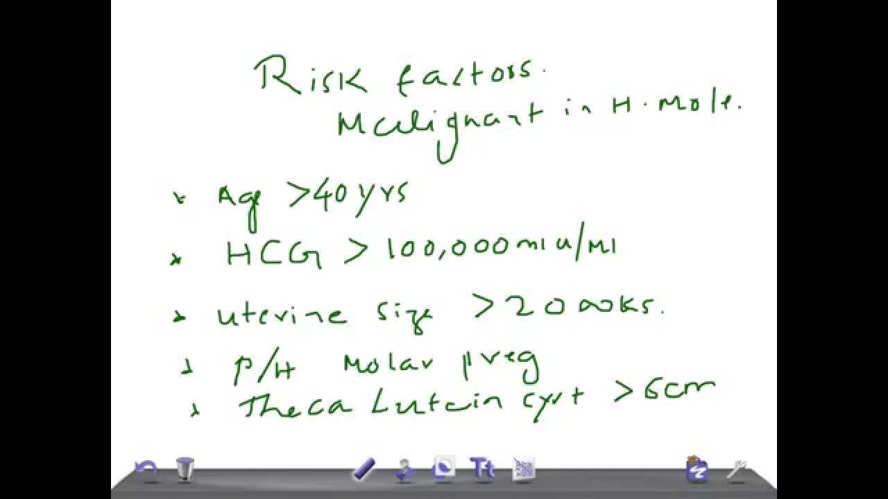 QUICK OBGYN: Risk factors for malignant change in H mole ( Hydatidiform ...