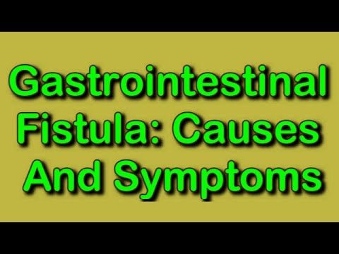 Gastrointestinal Fistula: Causes And Symptoms - YouTube