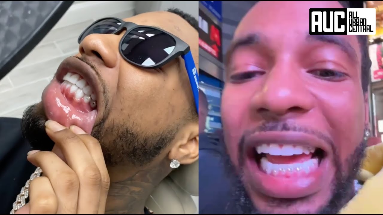 Key Glock Goes To Tokyo Gets Diamond Pointers Installed In His Teeth