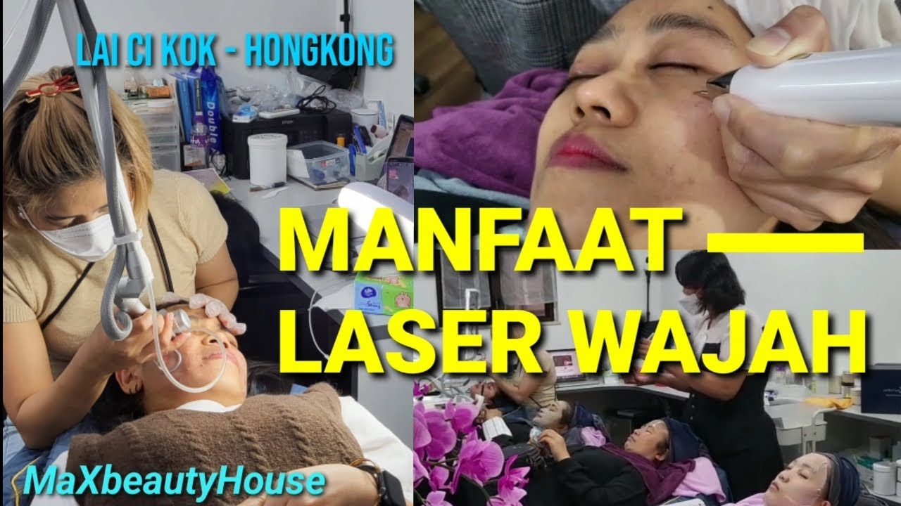 MANFAAT LASER WAJAH | MAXBEAUTY HOUSE HONGKONG - YouTube