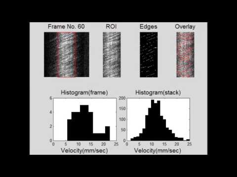 Adaptive-optics SLO imaging combined with widefield OCT and SLO enables ...