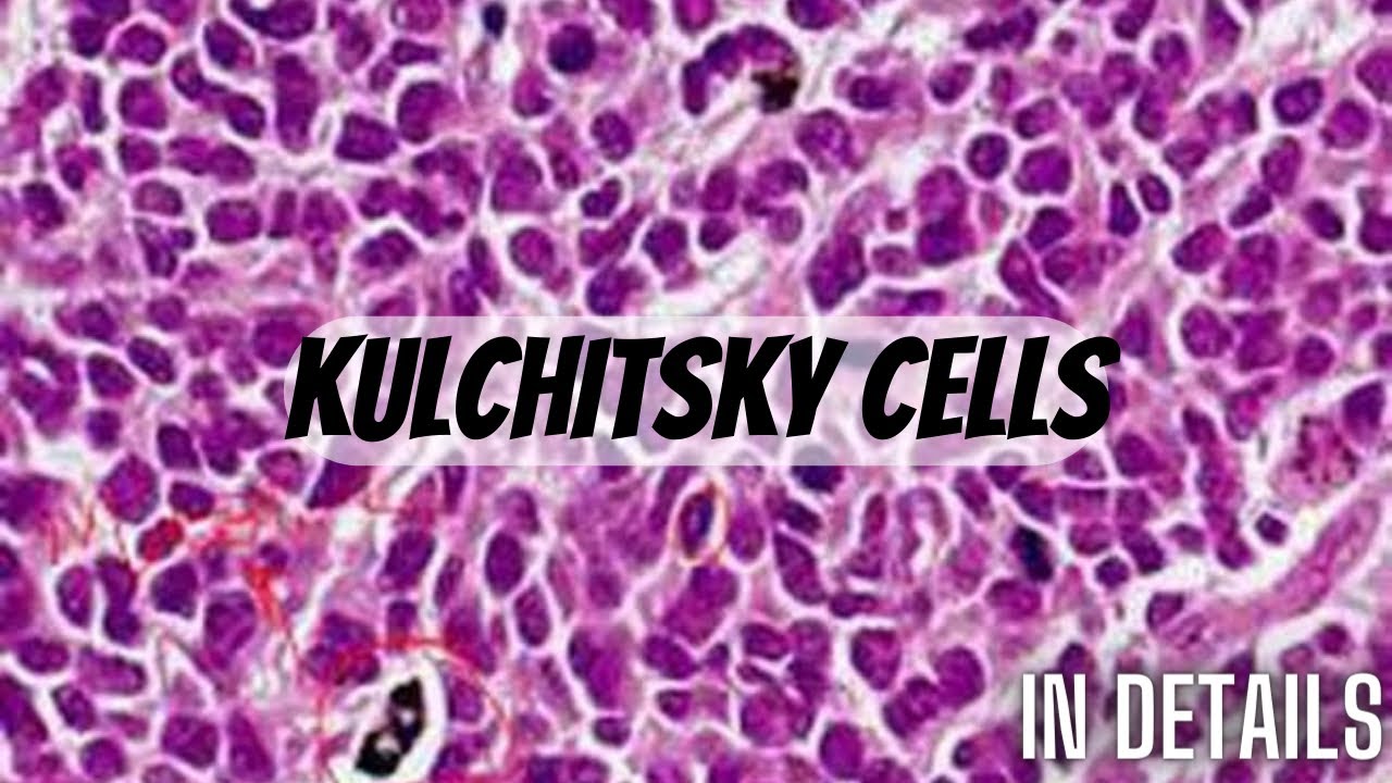 Kulchitsky cells in details. Cytology part 77. - YouTube