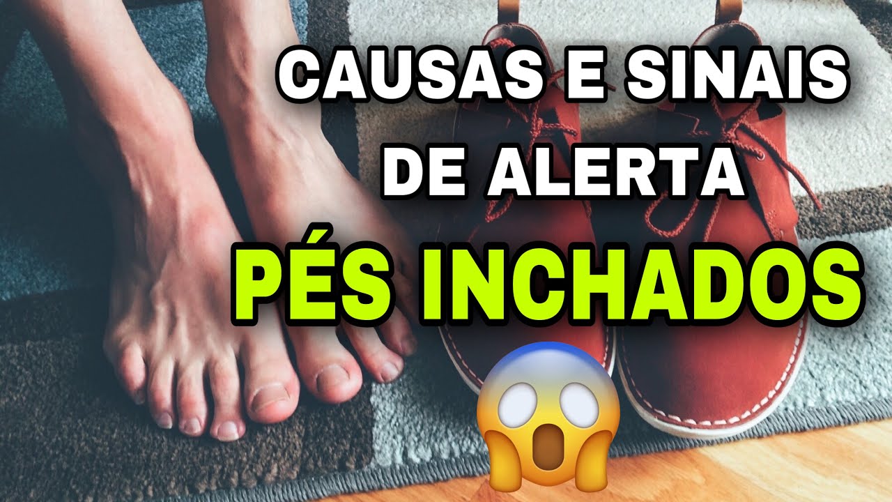 10 Causas de Pernas e Pés inchados e Sinais de ALERTA 🚨 - YouTube