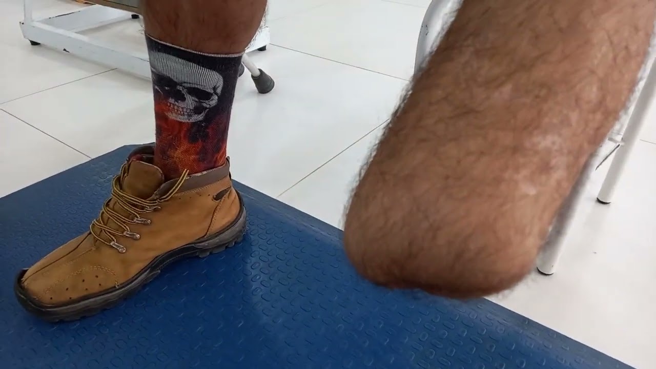 Sensibilidade do coto após amputação #fisioterapia #dor - YouTube