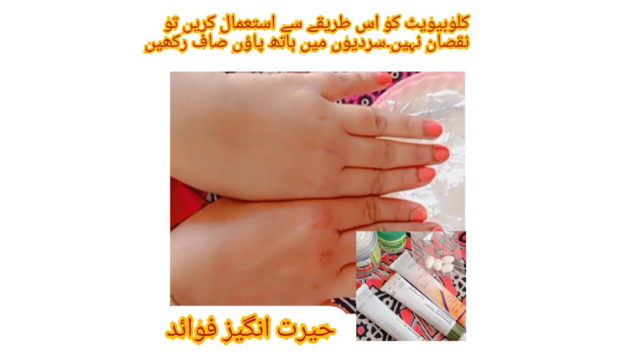 Clobevate Hand & feet amazing farmula | wonderful remedy | whitening ...