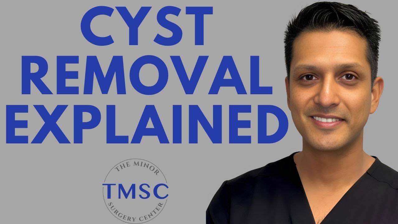 Cyst Removal Explained - The Minor Surgery Center - YouTube