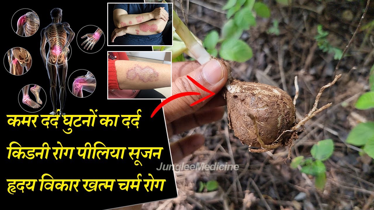 Junglee Pyaj चर्म रोग, सभी प्रकार के जोड़ो का दर्द खत्म करने वाली जंगली ...