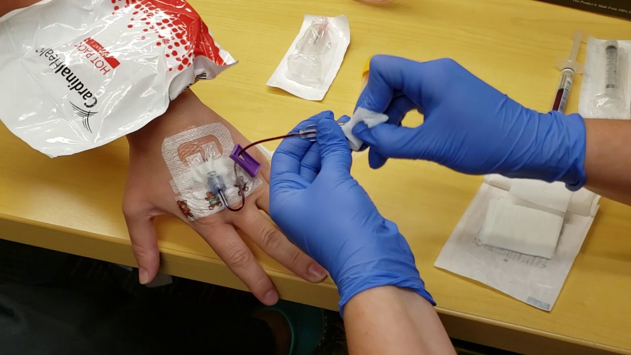 Phlebotomy from existing IV 2019 - YouTube