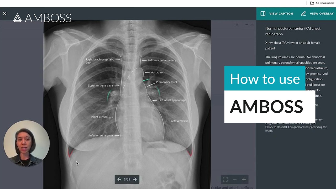 How to use AMBOSS for MD Students: Unlocking Success in In-House Exams ...