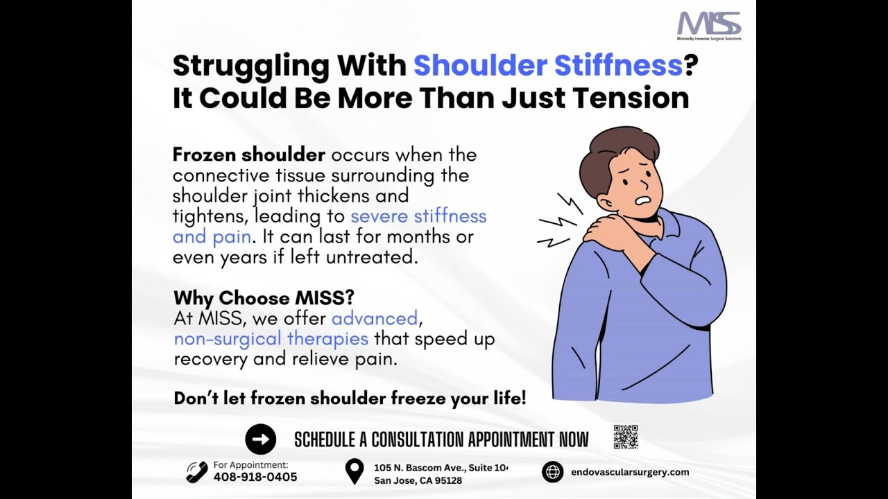 Shoulder Stiffness? Discover Non-Surgical Relief! - YouTube