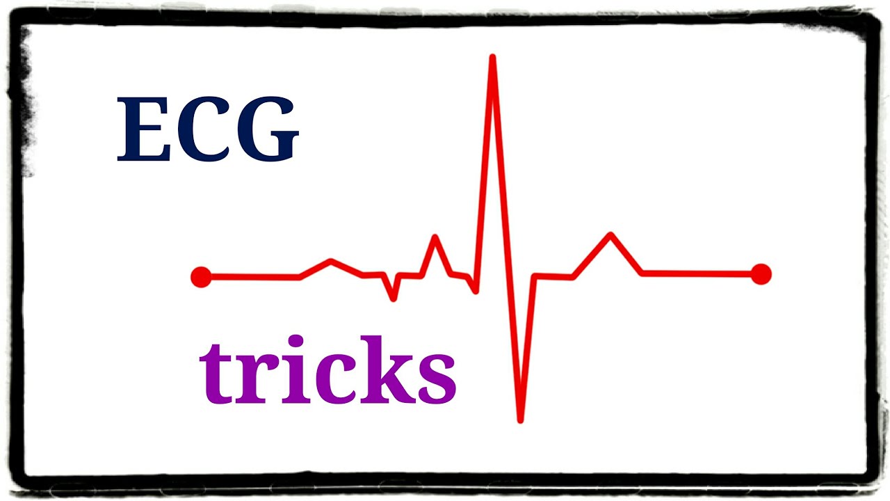 tricks for ECG/ electrocardiograph/ electrocardiogram/ecg test/ ecg ...