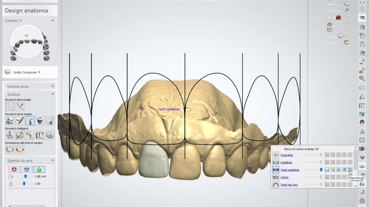 3Shape DentalSystem: playing with controls - YouTube