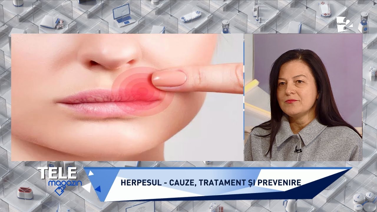 Herpesul. Ce provoacă apariţia lui şi cum îl tratăm corect - YouTube
