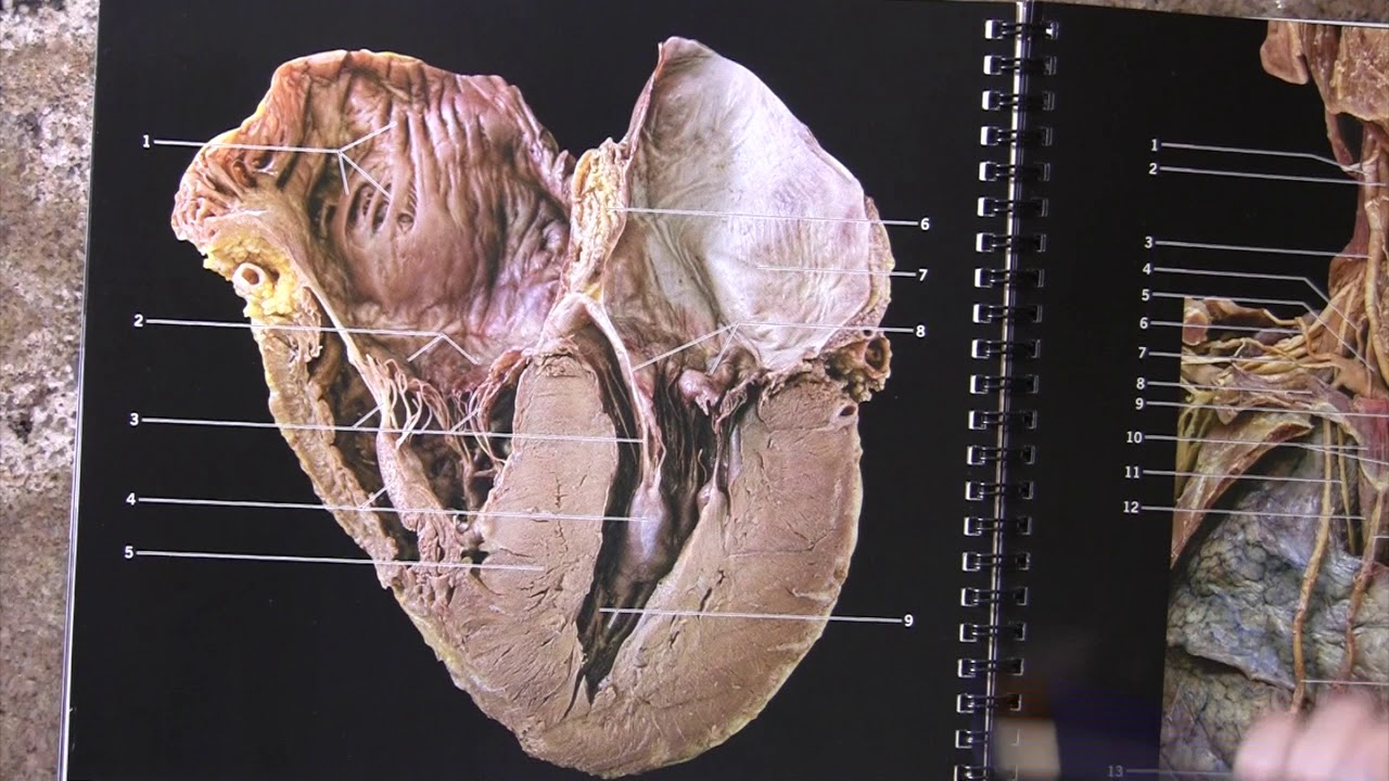 Heart Anatomy Atlas Overview - YouTube