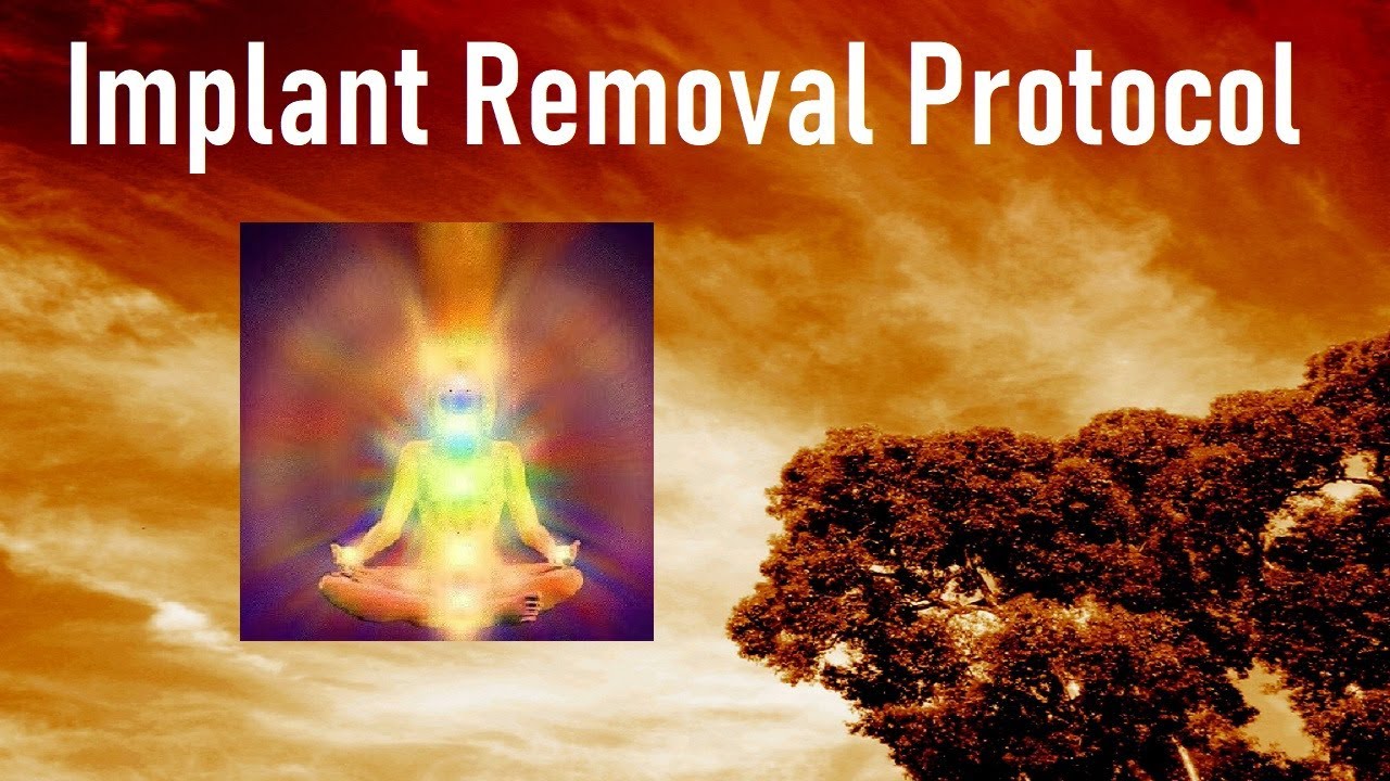 Implant Removal Protocol - YouTube