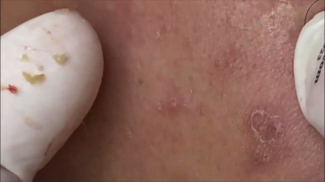 Enjoy Watch How To Take Care Your Skin At Spa Salon Part 179 Youtube