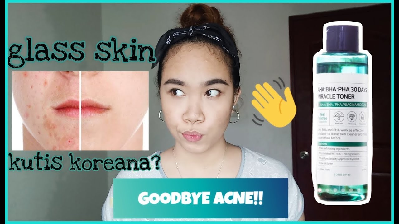 Goodbye Acne! 30 days Miracle toner Review Update (20th day of using ...