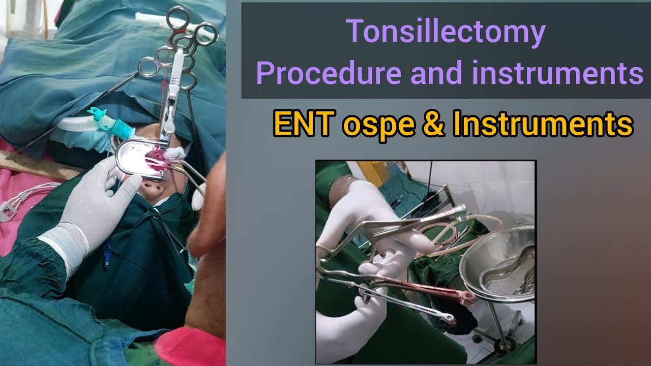 Tonsillectomy Thorat Surgery Instruments // ENT Ospe - YouTube