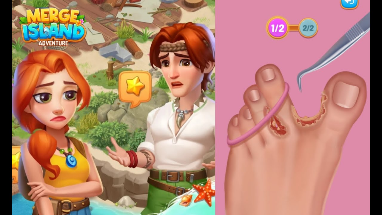 Adventure Island Merge | Athlete's foot 🦶Level 4 Part 4 ASMR - YouTube