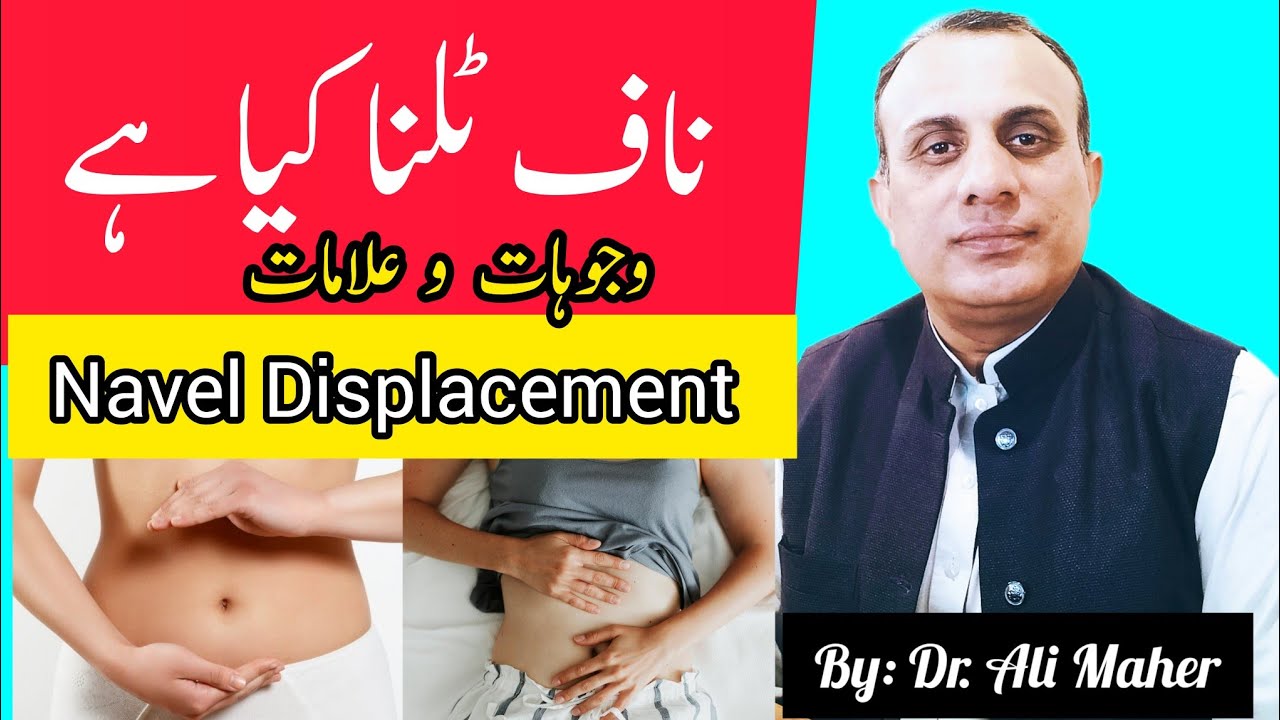 Navel Displacement Belly Button Pain YouTube navel-displacement-belly-button-pain-youtube