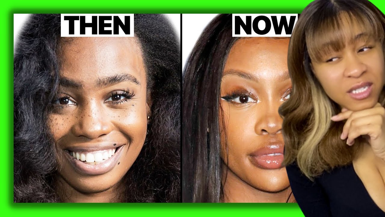 SZA New Face | Plastic Surgery Analysis | reaction - YouTube