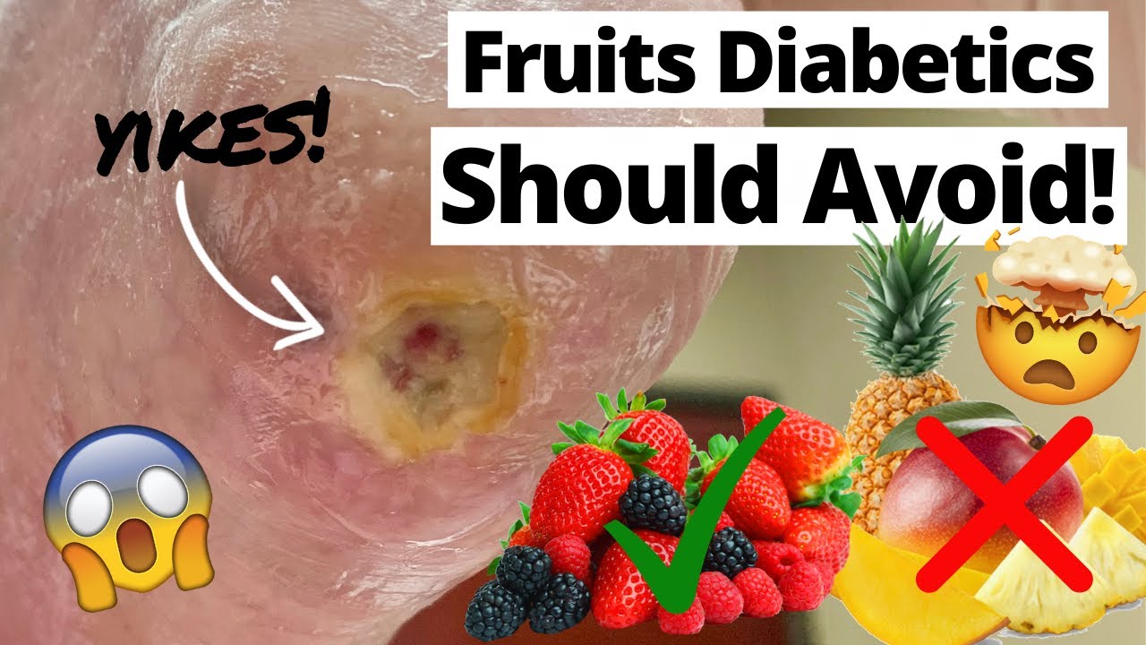 Fruits Diabetics Should Avoid At ALL COSTS YouTube fruits-diabetics-should-avoid-at-all-costs-youtube