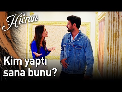 Hicran 158. Bölüm - Kim Yaptı Sana Bunu?