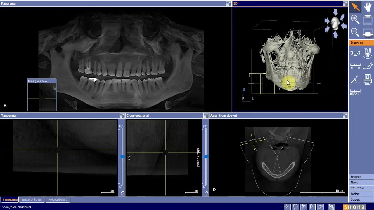 CBCT Axial Image Plane - YouTube