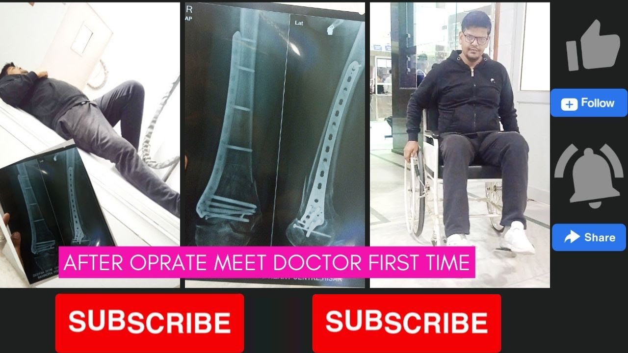 DOCTOR SE OPERATION KE BAD PEHLI BAR MILE || MEET AFTER OPERATION ...