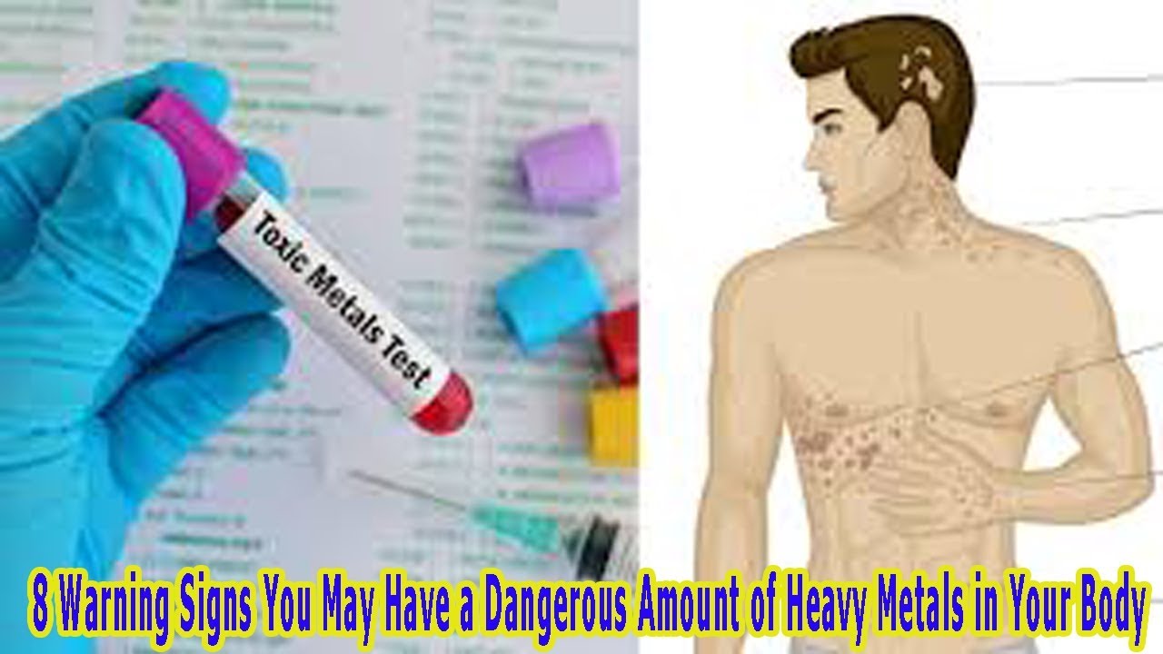 8 Warning Signs You May Have a Dangerous Amount of Heavy Metals in Your ...