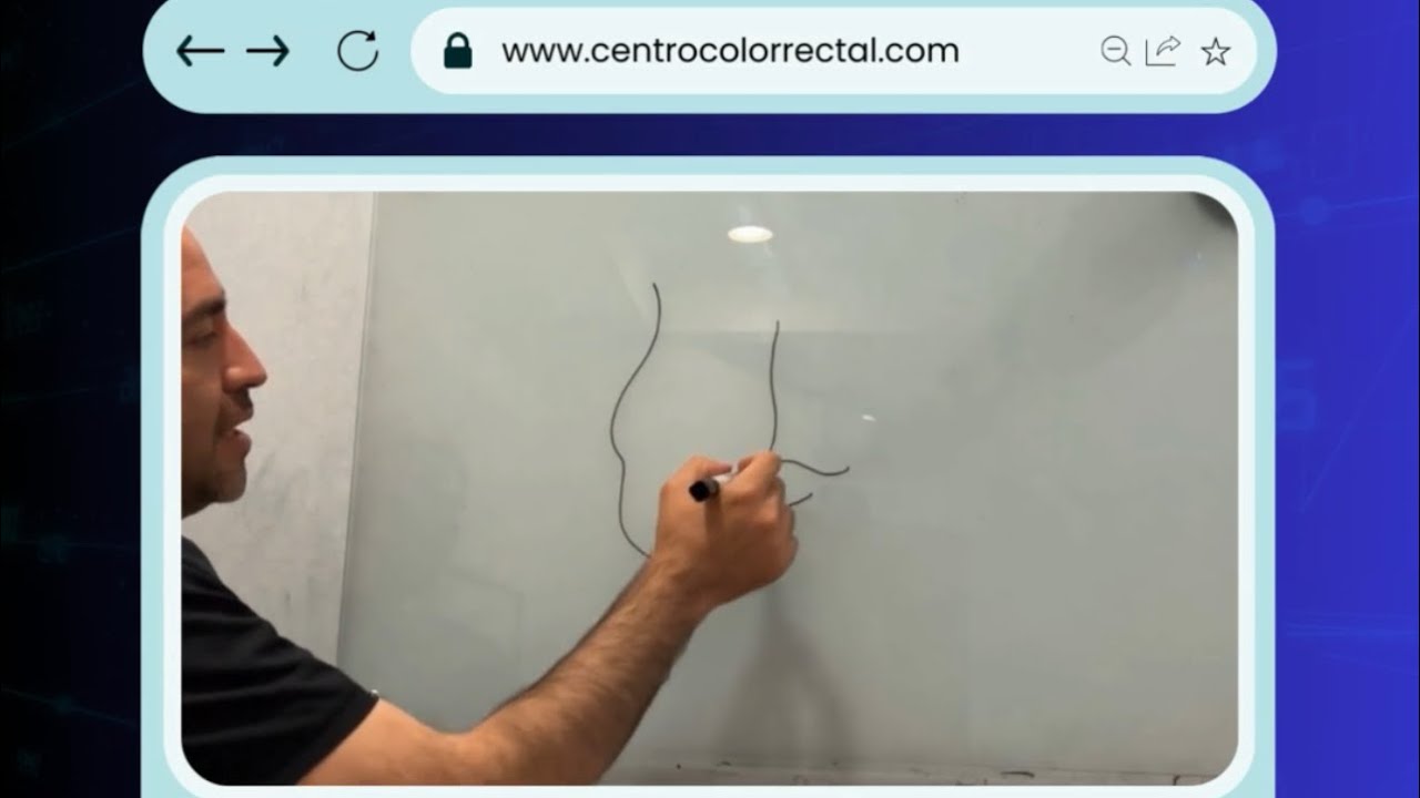 Cómo se realiza un neo-malone o neo-apendicostomía explicado muy ...