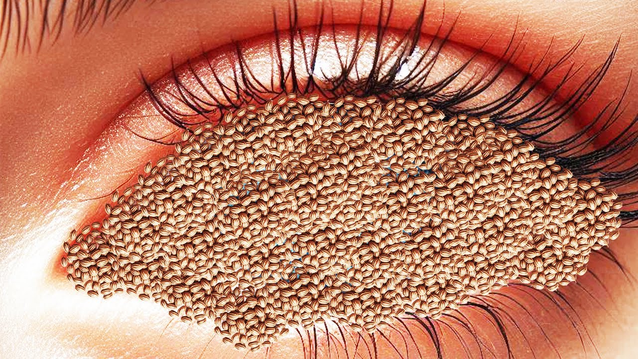 ASMR Eye Treatment Maggots infection Removal 😑 ASMR ANIMATION TREATMENT ...