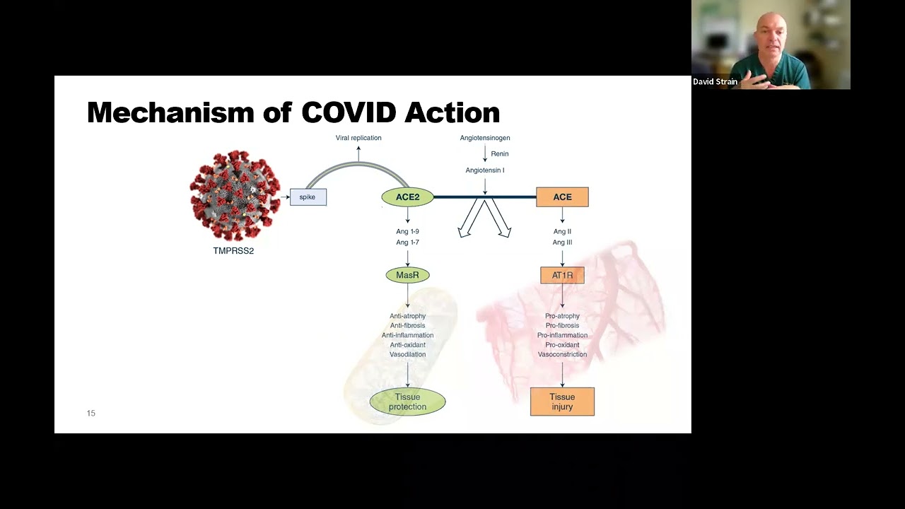 Dr David Strain : Long COVID - The sting in the tail. - YouTube