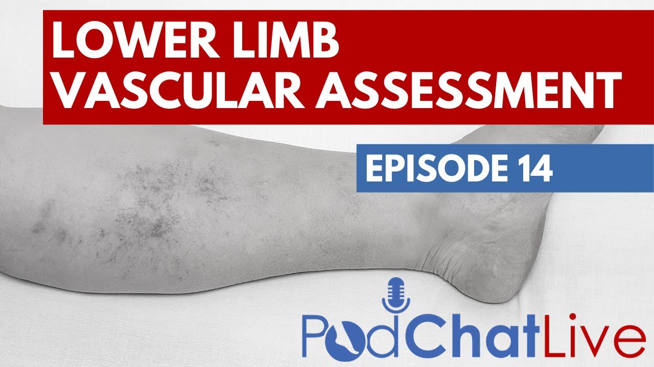 PodChatLive: Episode 14 with Peta Tehan and Martin Fox [Vascular] - YouTube