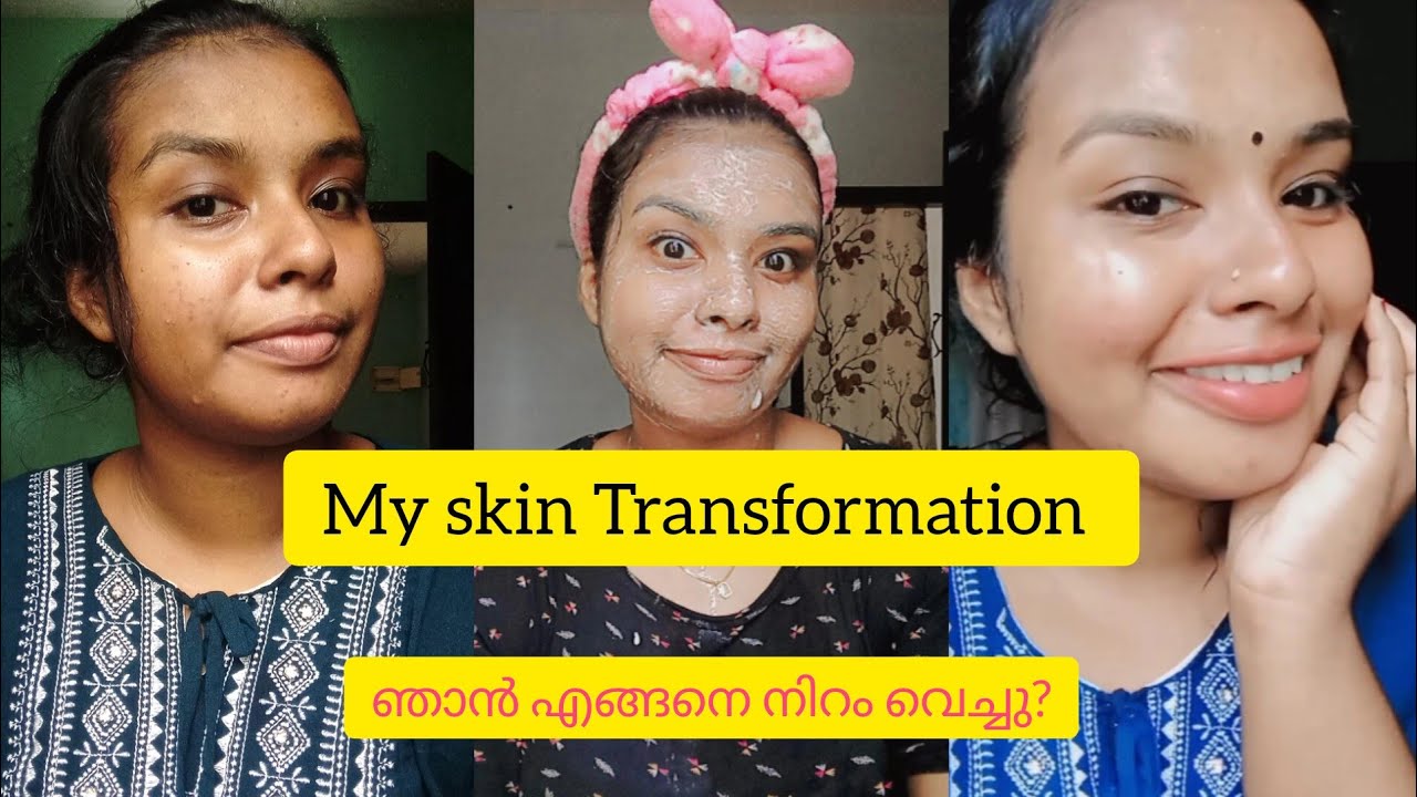 my skin Transformation journey 😁 ഞാൻ എങ്ങനെ നിറം വെച്ചു. എല്ലാരോടും ...