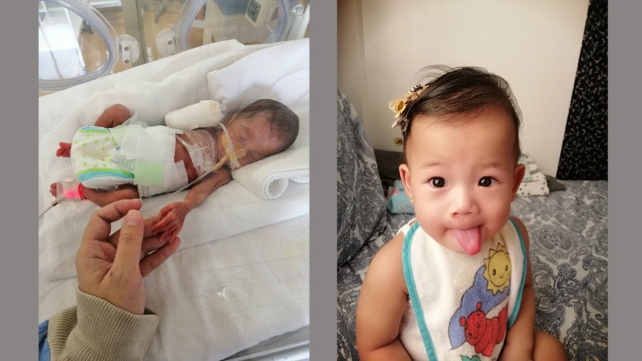 Our Miracle Baby: 27-Week Old Baby Turns 1 - YouTube