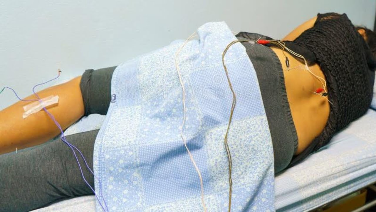 ELECTRICAL STIMULATION OF NEEDLES (ELECTROACUPUNCTURE) - YouTube