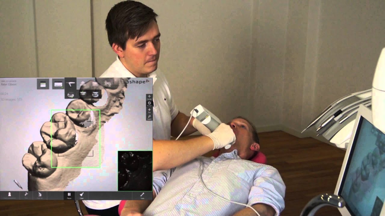 TRIOS® Tips & Tricks (for Cart Systems) - YouTube