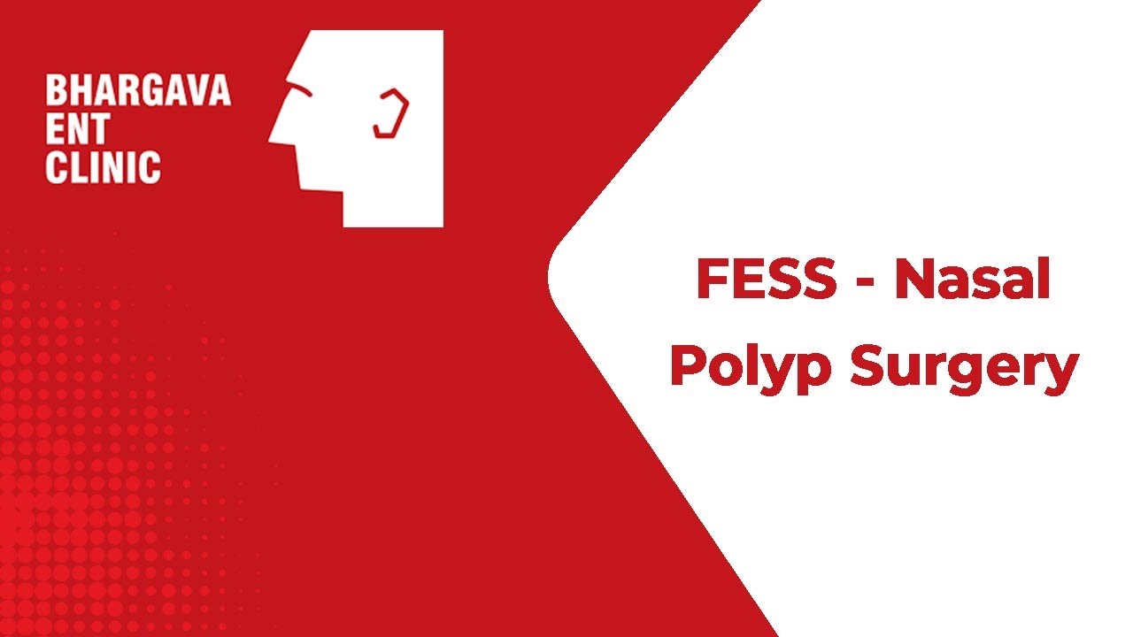 FESS - Nasal Polyp Surgery - YouTube