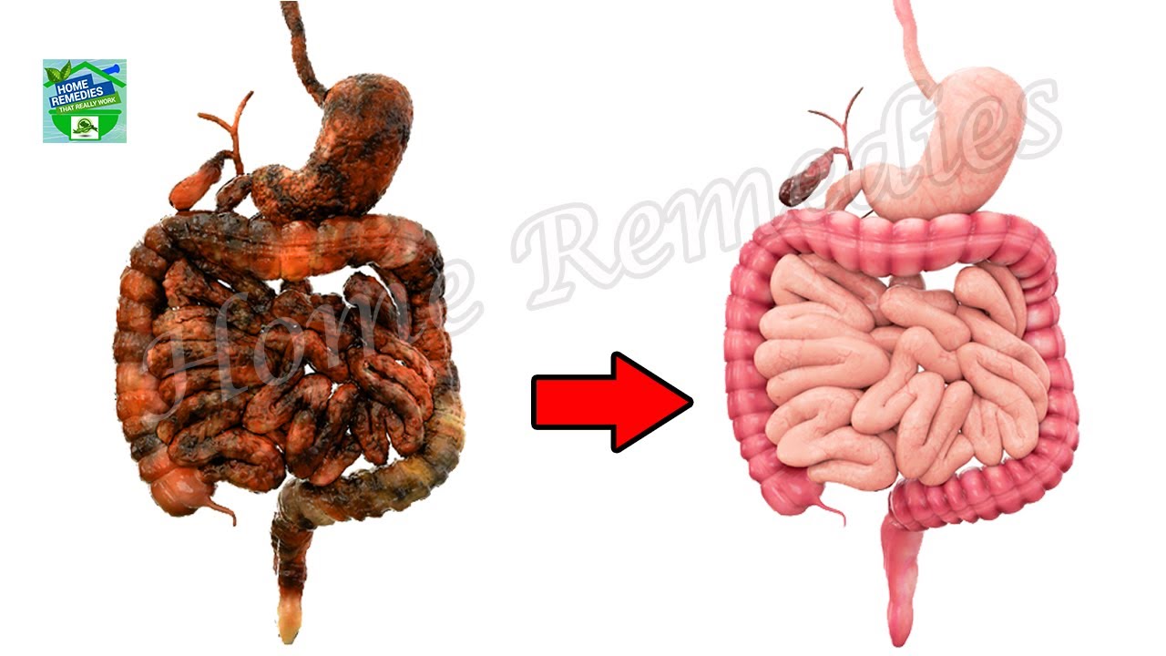 How To Clean Your Stomach and Intestines Naturally With 1 Ingredient ...