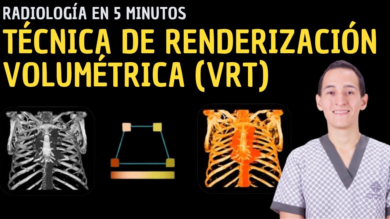 Radiología en 5 minutos: Técnica de Renderización Volumétrica (VRT ...