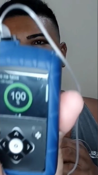 🔹1 MÊS USANDO BOMBA DE INSULINA 780G #medtronic - YouTube