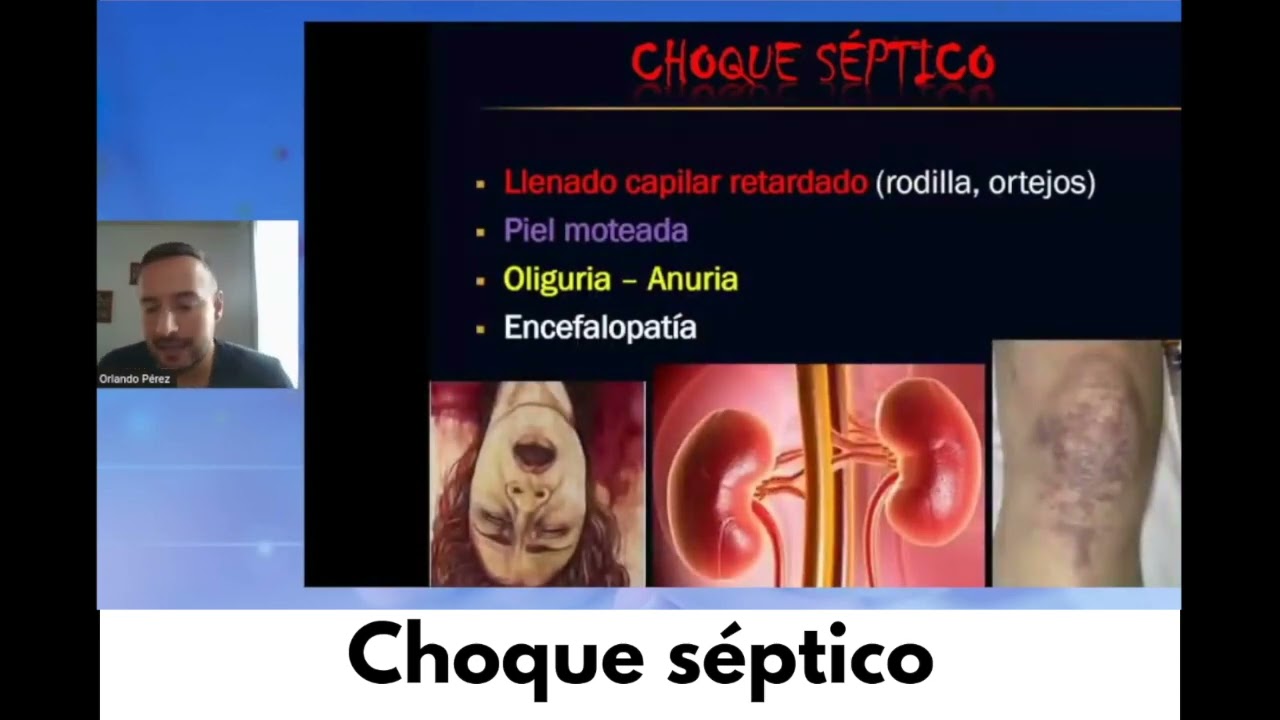 Choque S ptico Definici n Y Fisiopatolog a YouTube Choque S ptico Definici n Y Fisiopatolog a YouTube